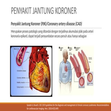 Penyakit Jantung Koroner. (PJK).pptx