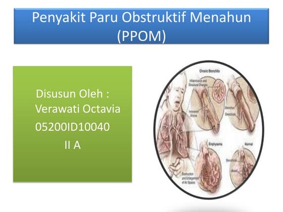 POWERPOINT TB PARU | PPTX