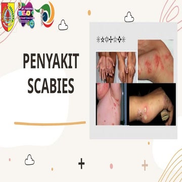 power point prsentation penyakit scabies | PPTX