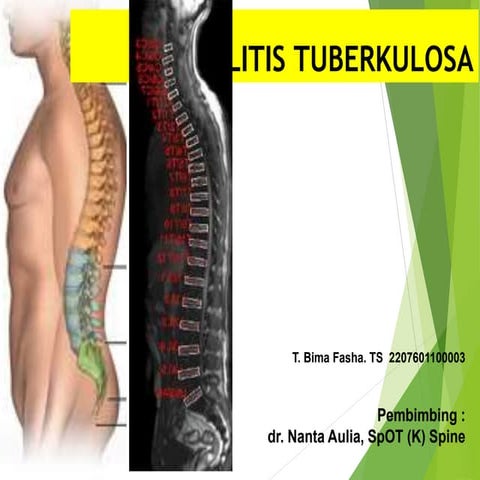 PPT_Spondilitis_TB.ppt