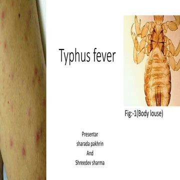 Ppt typhus fever 01.pptx