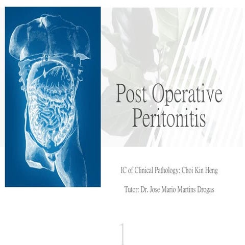 Post Operative Peritonitis | PDF
