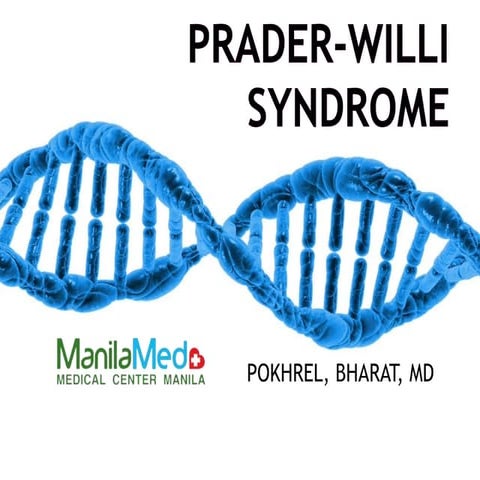 Prader willi syndrome | PPTX