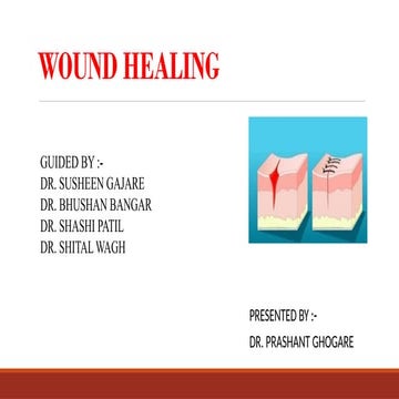 PRASHANT SEMINAR WOUND HEALING.pptxNJJFJJF | PPTX