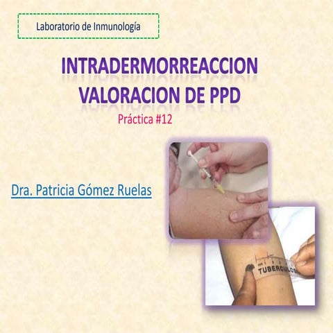 Práctica12 intradermorreaccion tuberculina | PPTX