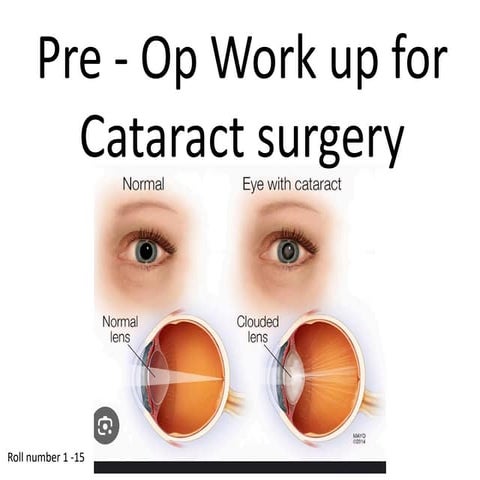 Pre-Op_Workspace_Cataract_Surgery_Updatedpptx_202_250728_210419.pdf