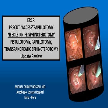 Precut ERCP, Fistulotomy, Papillotomy, Transpancreatic sphincterotomy ...