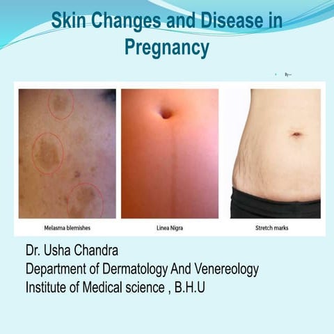 Pregnancy skin changes | PPTX