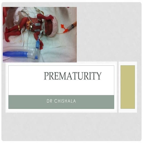 Prematurity - presentation final .pptx