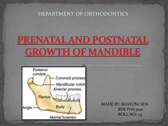 Mnemonics : Histological zones of enamel and dentinal caries | PPTX