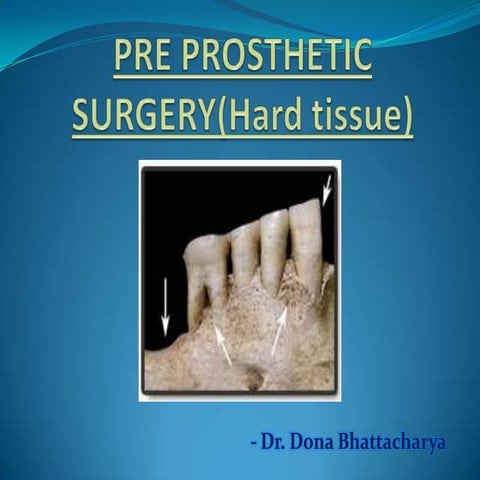 Vestibuloplasty | PPTX