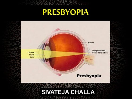 diagram of eye | PDF