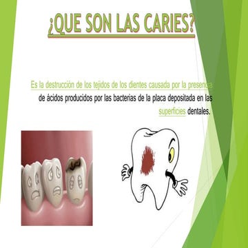 Historia Natural de la Caries Dental | PPTX