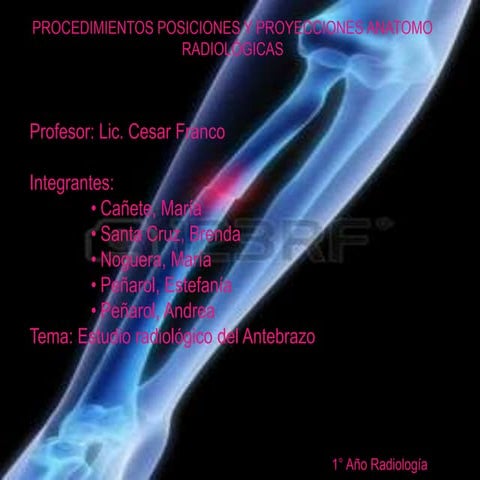 PROCEDIMIENTOS POSICIONES PROYECCIONES ANATOMO RADIOLÓGICAS | PPTX
