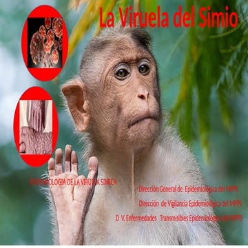 La viruela del simio. Cómo afecta la salud | PPTX