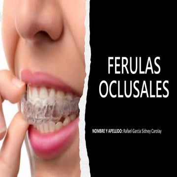 tipos de ferula | PPTX