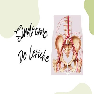 Comprehensive Overview of Leriche Syndrome: Causes, Symptoms, Diagnosis ...