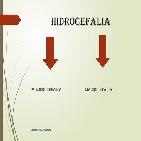 macro y microcefalia | PPTX