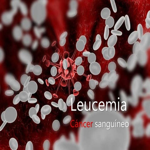 Leucemia | PPTX