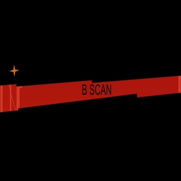 b scan of eye | ODP