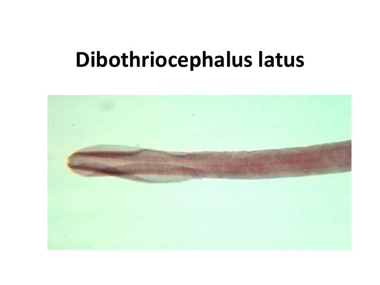 Diphyllobothrium Latum