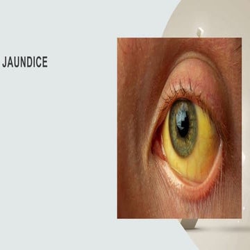 JAUNDICE.pptx