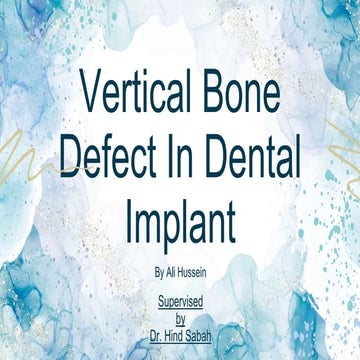 Ridge Augmentation Procedures | PPTX