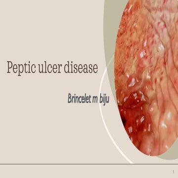 PEPTIC ULCER DISEASE,SLIDESHARE PRESENTATION | PDF