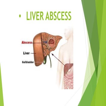 Liver abscess presentation | PPTX