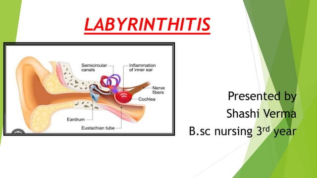 Labyrinthitis | PPTX