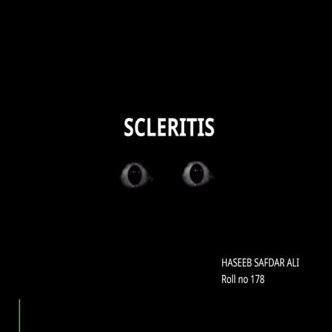 Scleritis Opthalmology 4th year MBBS.pptx