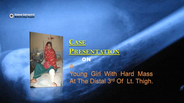 Peripheral Vascular Disease Case Presentation | PPTX