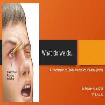 Presentation - Ocular Trauma.- injury to eye | PPTX