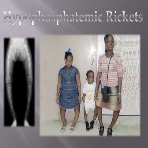 Hypophosphatemic Rickets | PPT