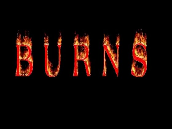 Burn | PPTX