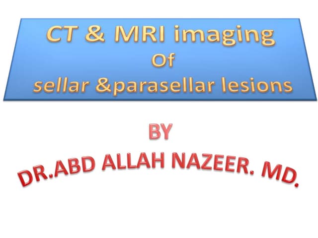 sellar and suprasellar mass pituitary gland .pptx