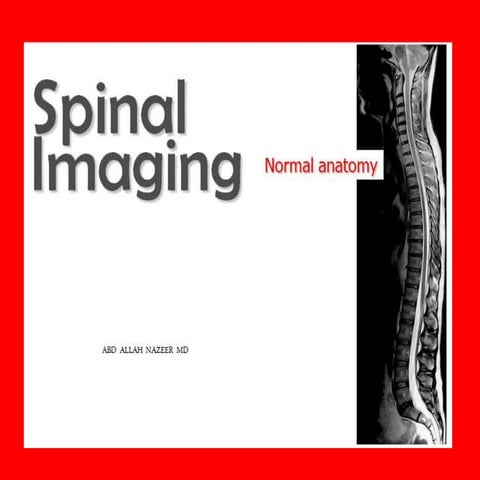 Presentation1.pptx spine | PPT