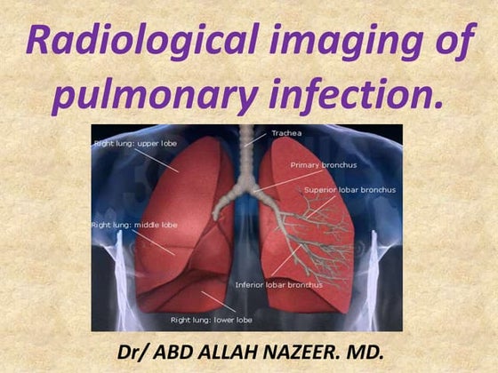 necrotizing pneumonia.ppt