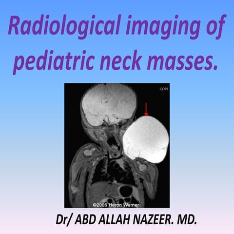 Presentation1.pptx, radiological imaging of pediatric neck masses. | PPTX