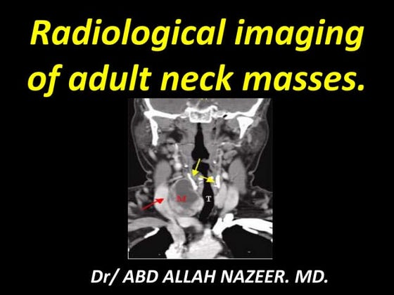Ct Neck Anatomy Ppt The Radiology Assistant : Anatomy And Pathology Of