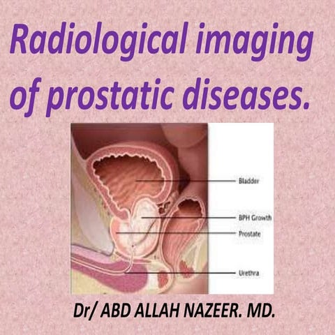 Prostate ultrasound (basic) | PPTX