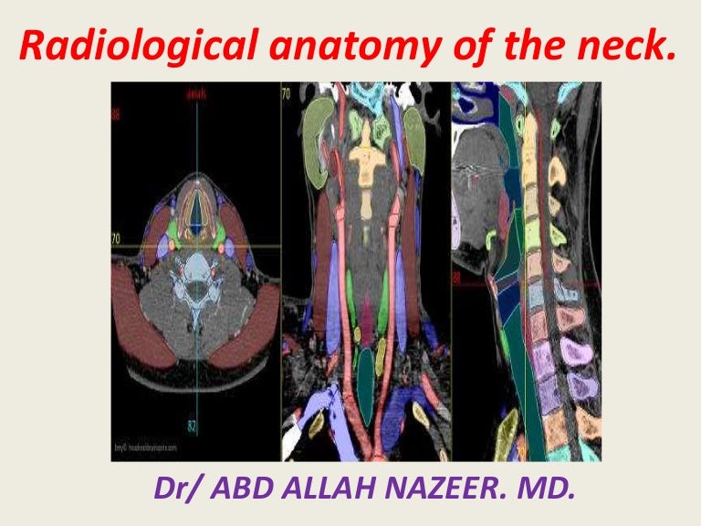 Presentation1.pptx, radiological anatomy of the neck.
