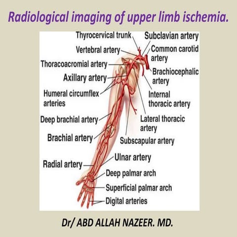 Vessels of upper limb