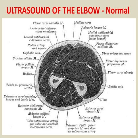 Presentation1.pptx, ultrasound examination of the elbow joint. | PPTX