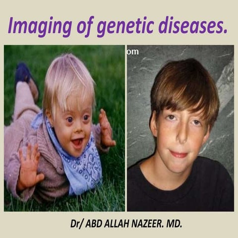 Presentation1.pptx, imaging of genetic diseases. (3) | PPTX