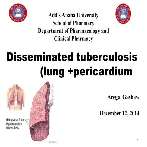 disseminated TB | PPTX