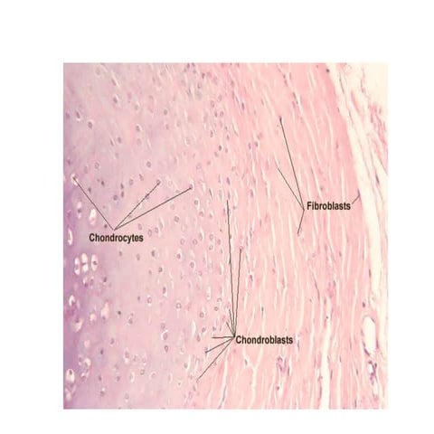 chondrocytes | PPTX