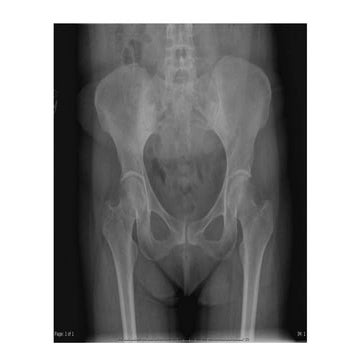 Photo Session Posterior Hip Dislocation Pptx 9893