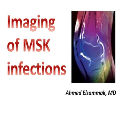 Imaging of musculoskeletal infections | PPTX