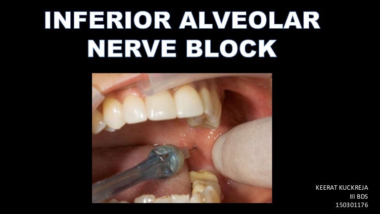 INFERIOR ALVEOLAR NERVE BLOCK